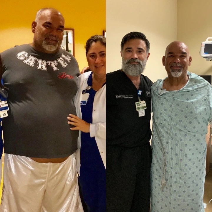 Bariatric Surgery Before & After Gallery | Miami VIP Surgery